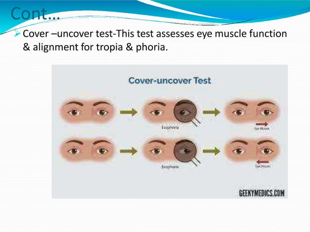Assessment of eye.pptx