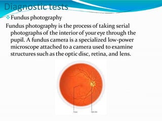 Assessment of eye.pptx