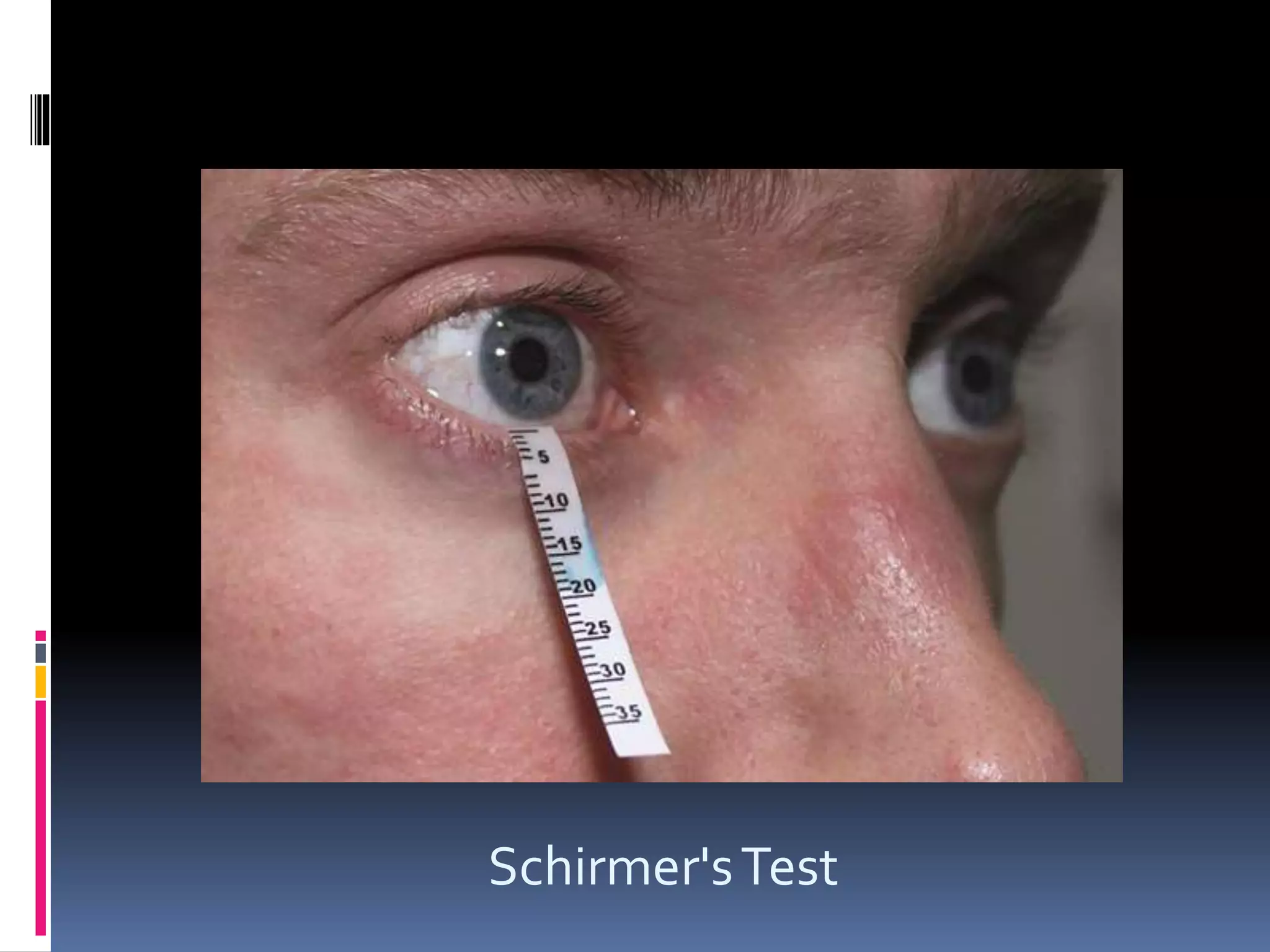 Assessment of facial nerve function | PPTX