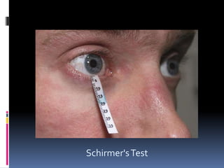 Assessment of facial nerve function | PPTX