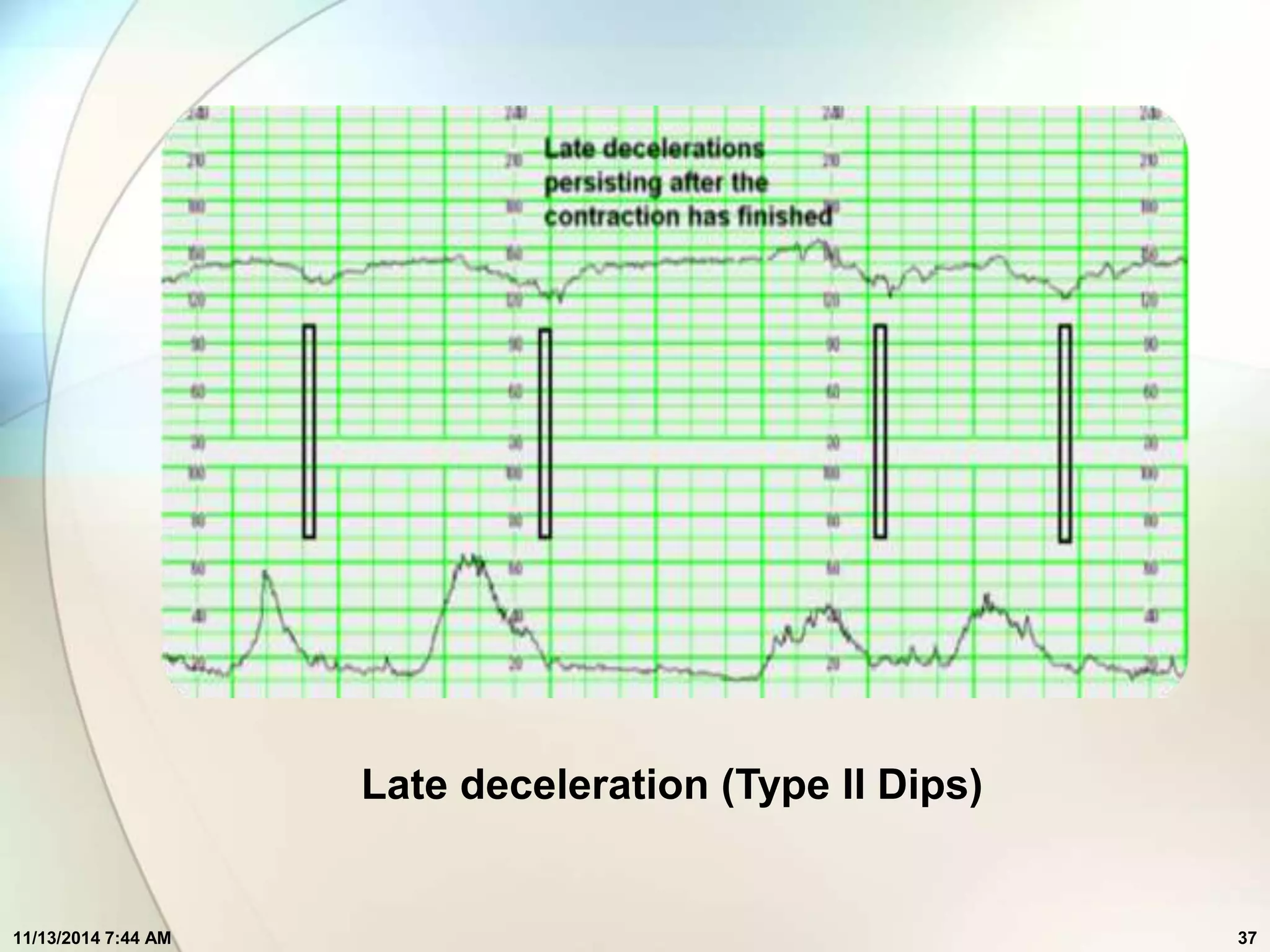 Assessment of fetal wellbeing | PPTX