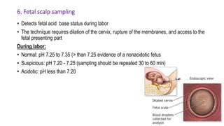 ASSESSMENT OF FETAL WELL BEING in obstetric bms.pptx