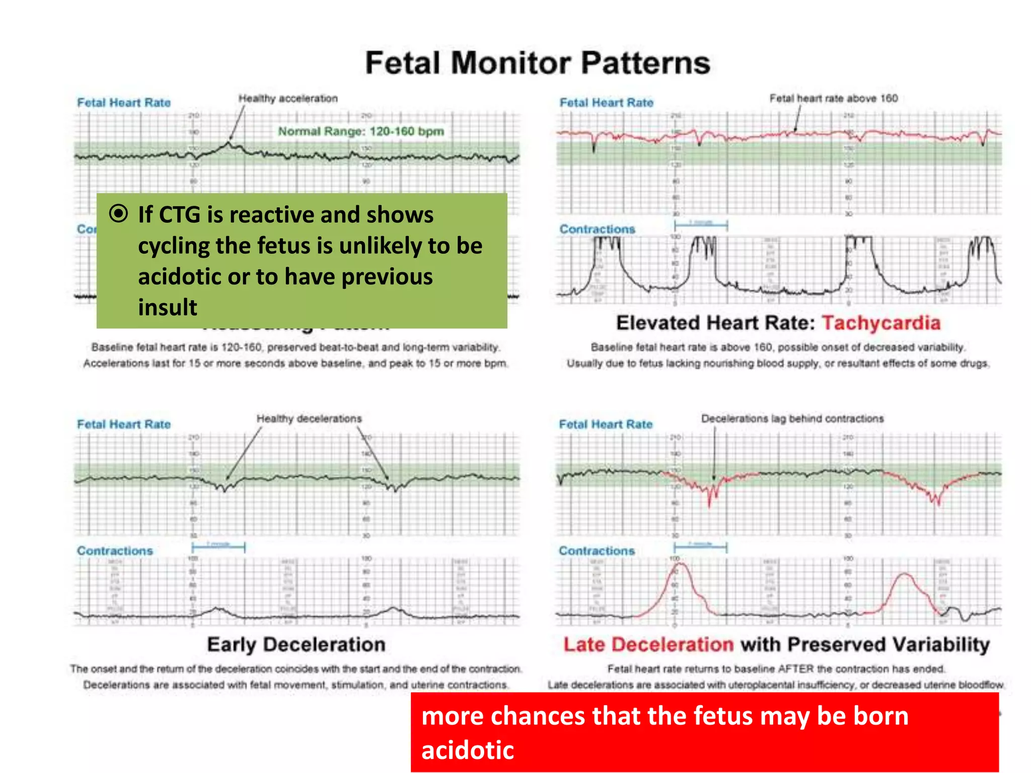 Assessment of fetal wellbeing in pregnancy and labour | PPTX