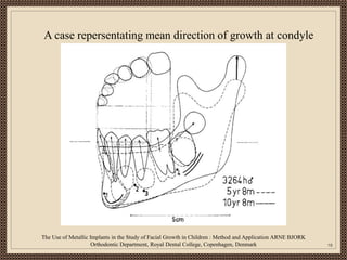 ASSESSMENT OF GROWTH AND DEVELOPMENT.pptx