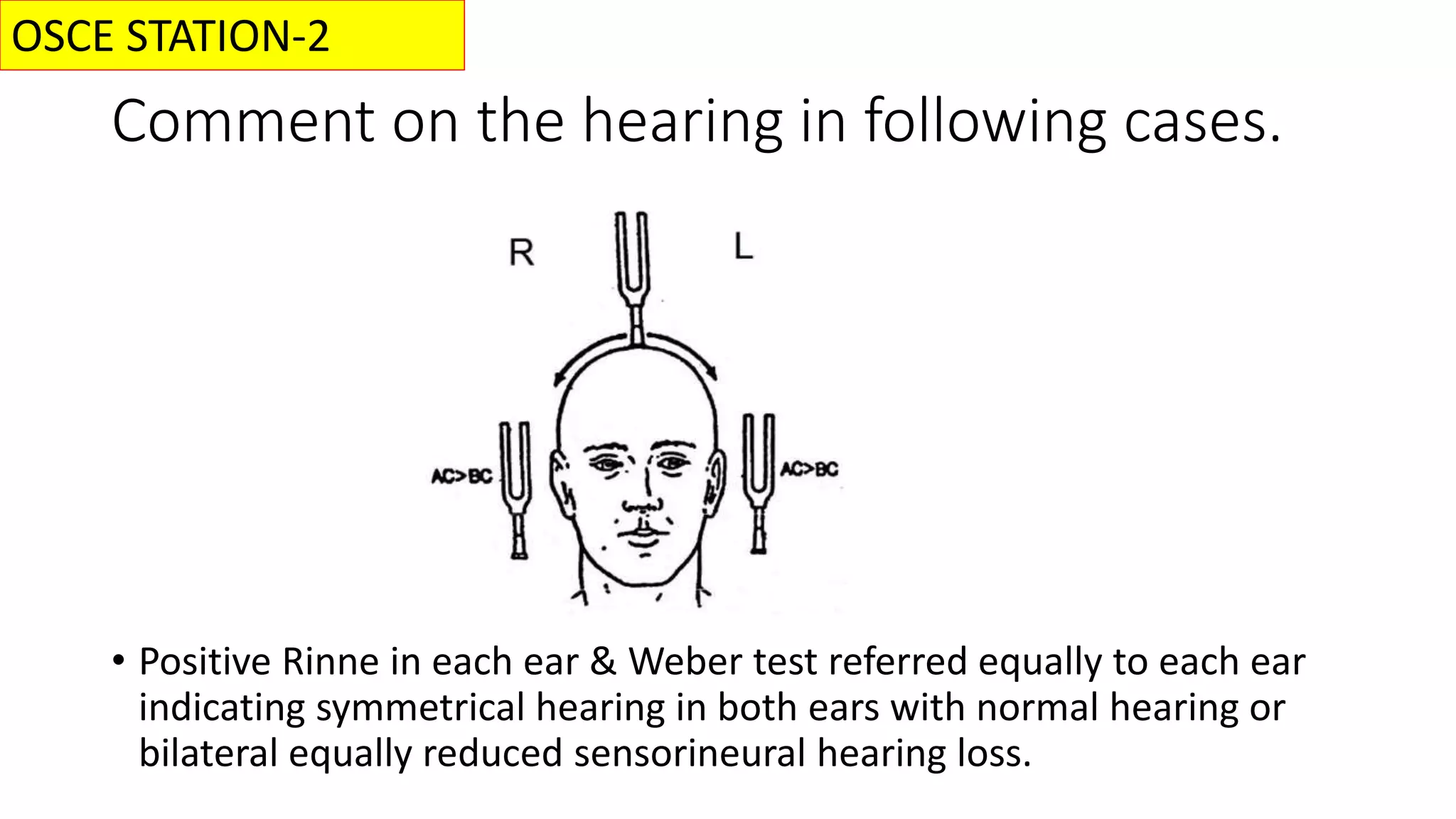 ASSESSMENT OF HEARING | PDF