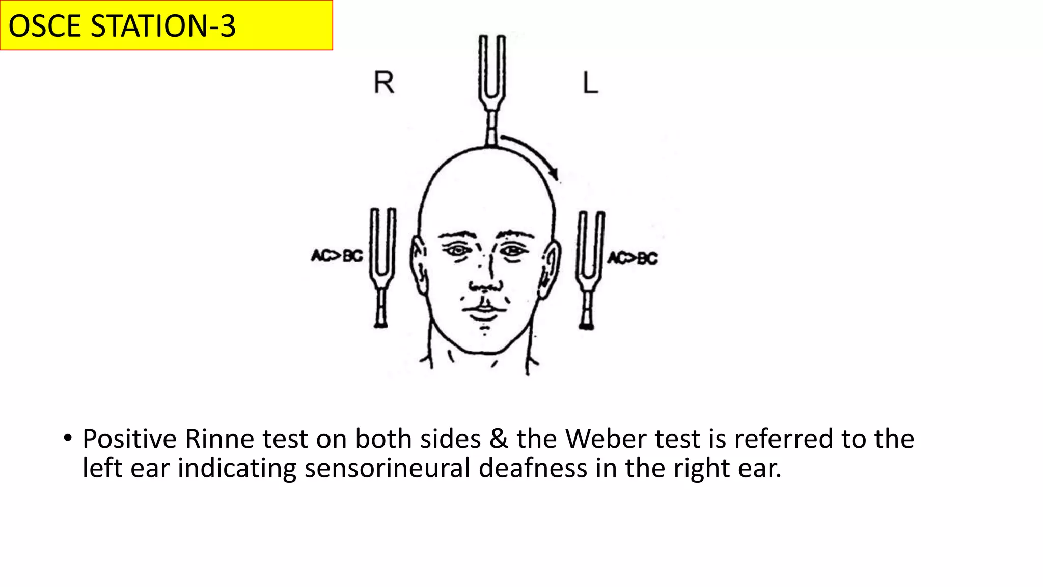 ASSESSMENT OF HEARING | PDF