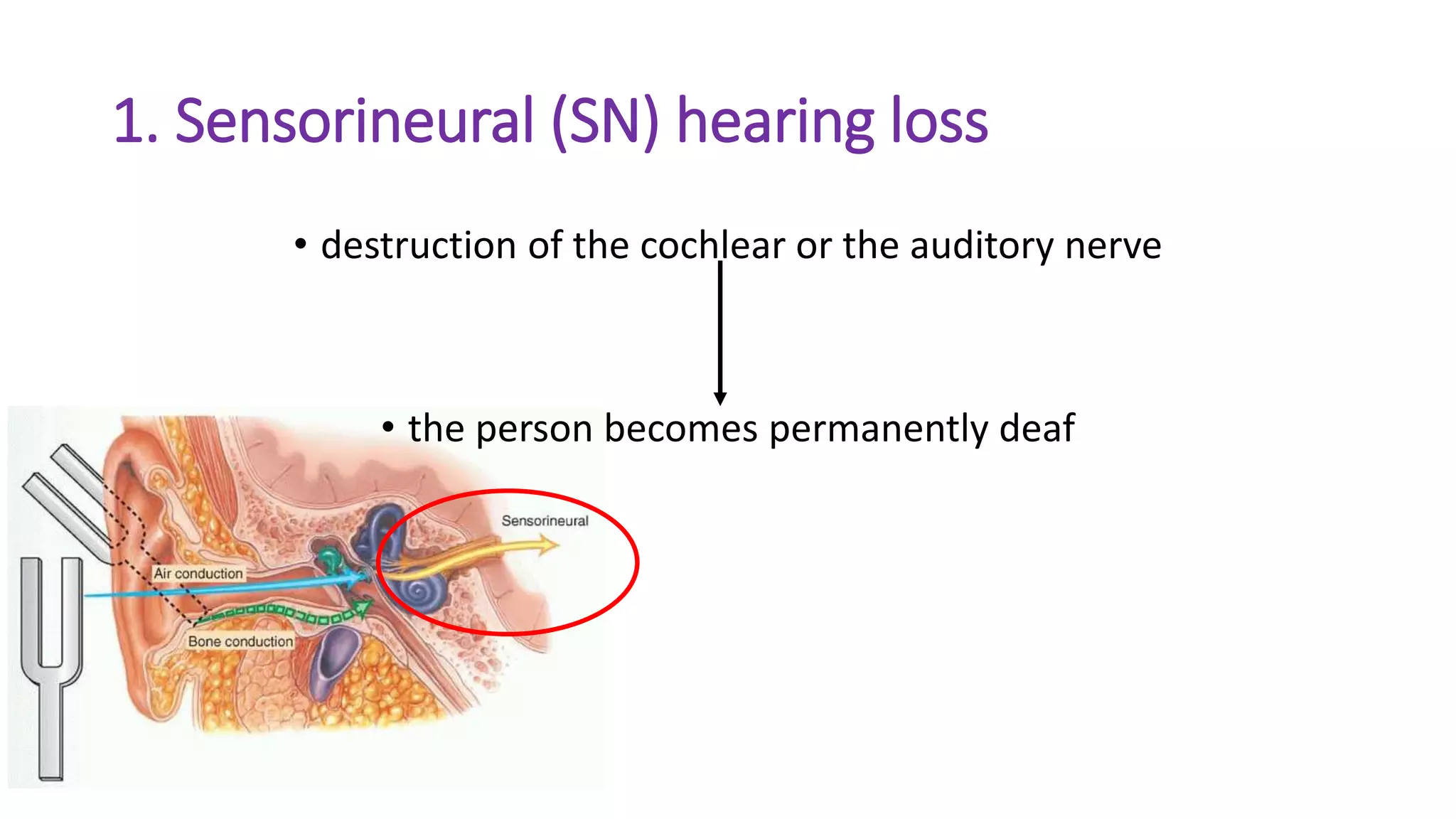 ASSESSMENT OF HEARING | PDF