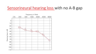 ASSESSMENT OF HEARING | PDF