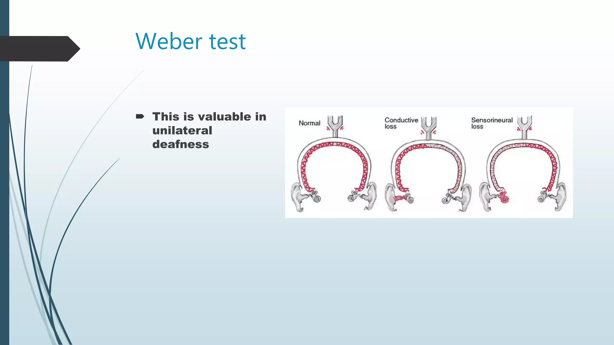 Assessment of hearing | PPTX