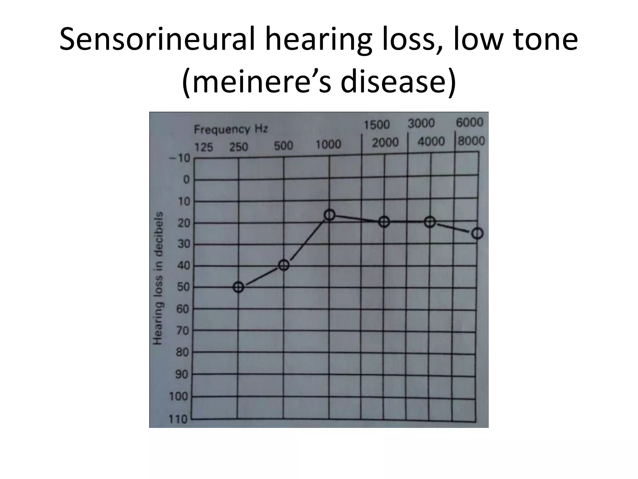 Assessment of hearing | PPTX