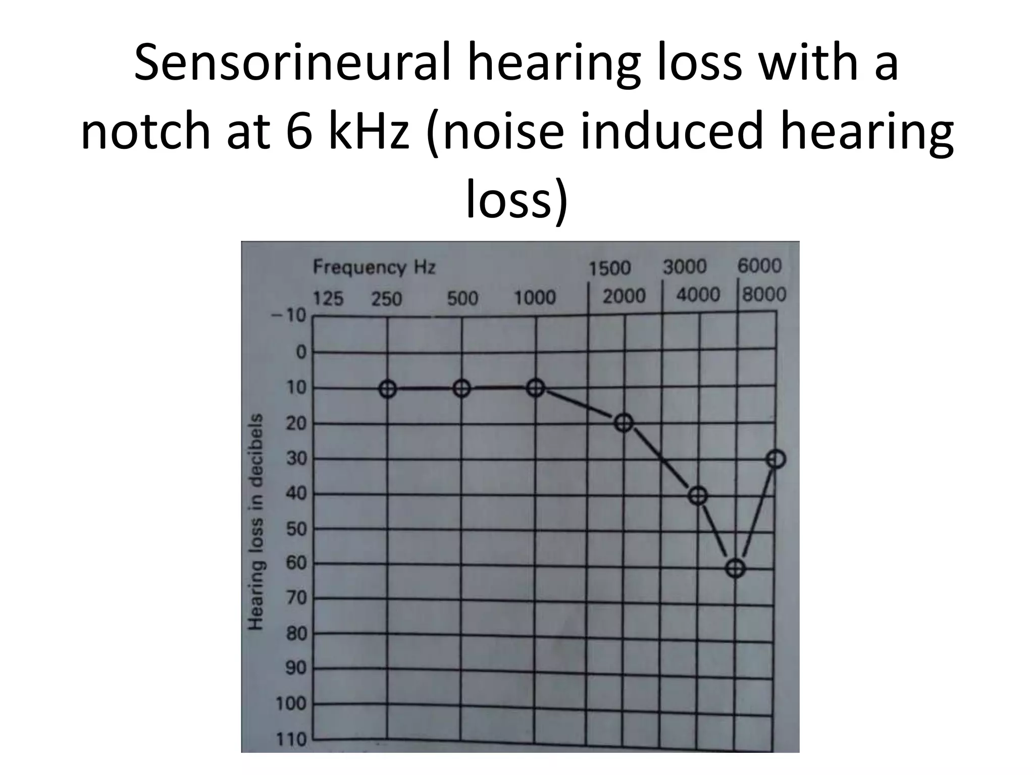 Assessment of hearing | PPTX