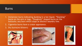 Assessmentof injuries | PPTX