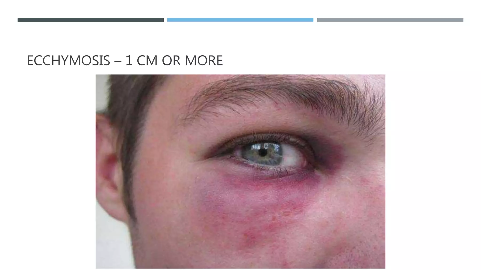 Clinical Assessment of integumentary system | PPTX