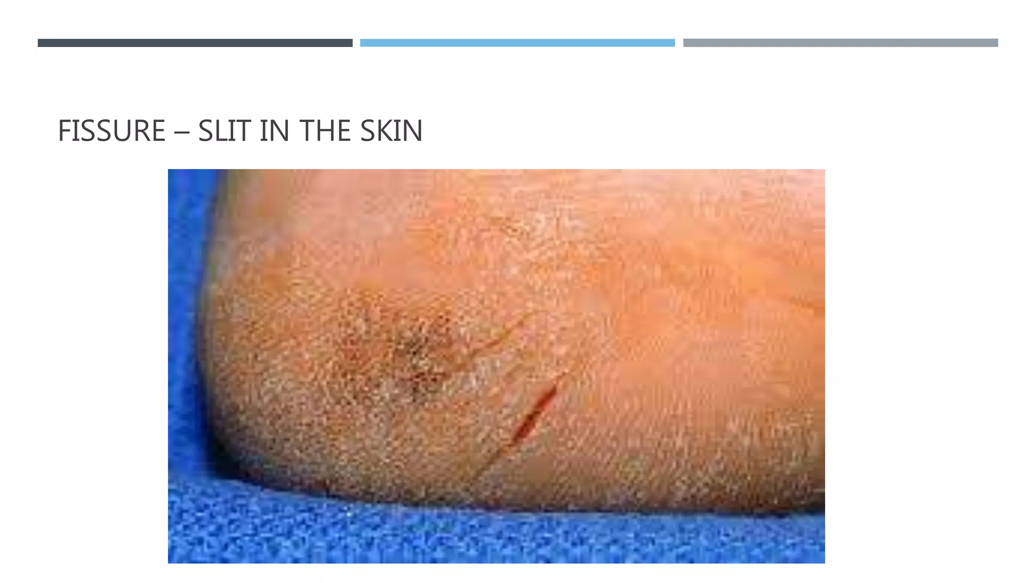 Clinical Assessment of integumentary system | PPTX