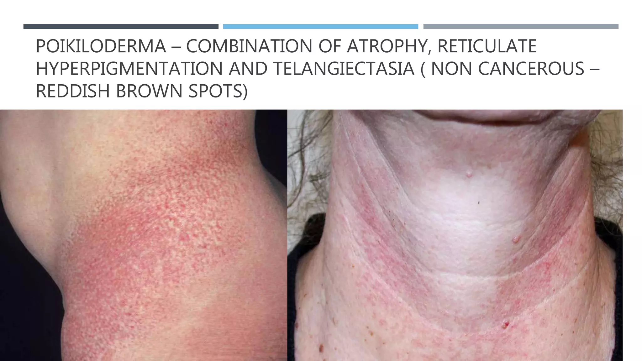 Clinical Assessment of integumentary system | PPTX