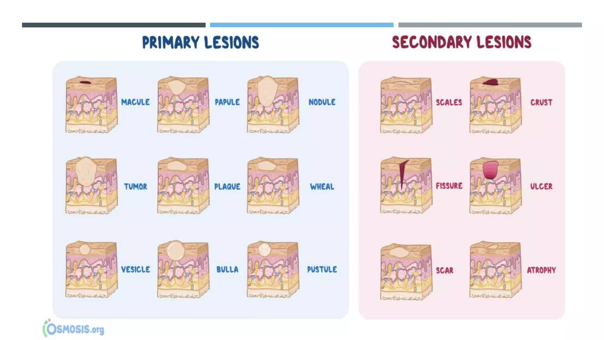 Clinical Assessment of integumentary system | PPT