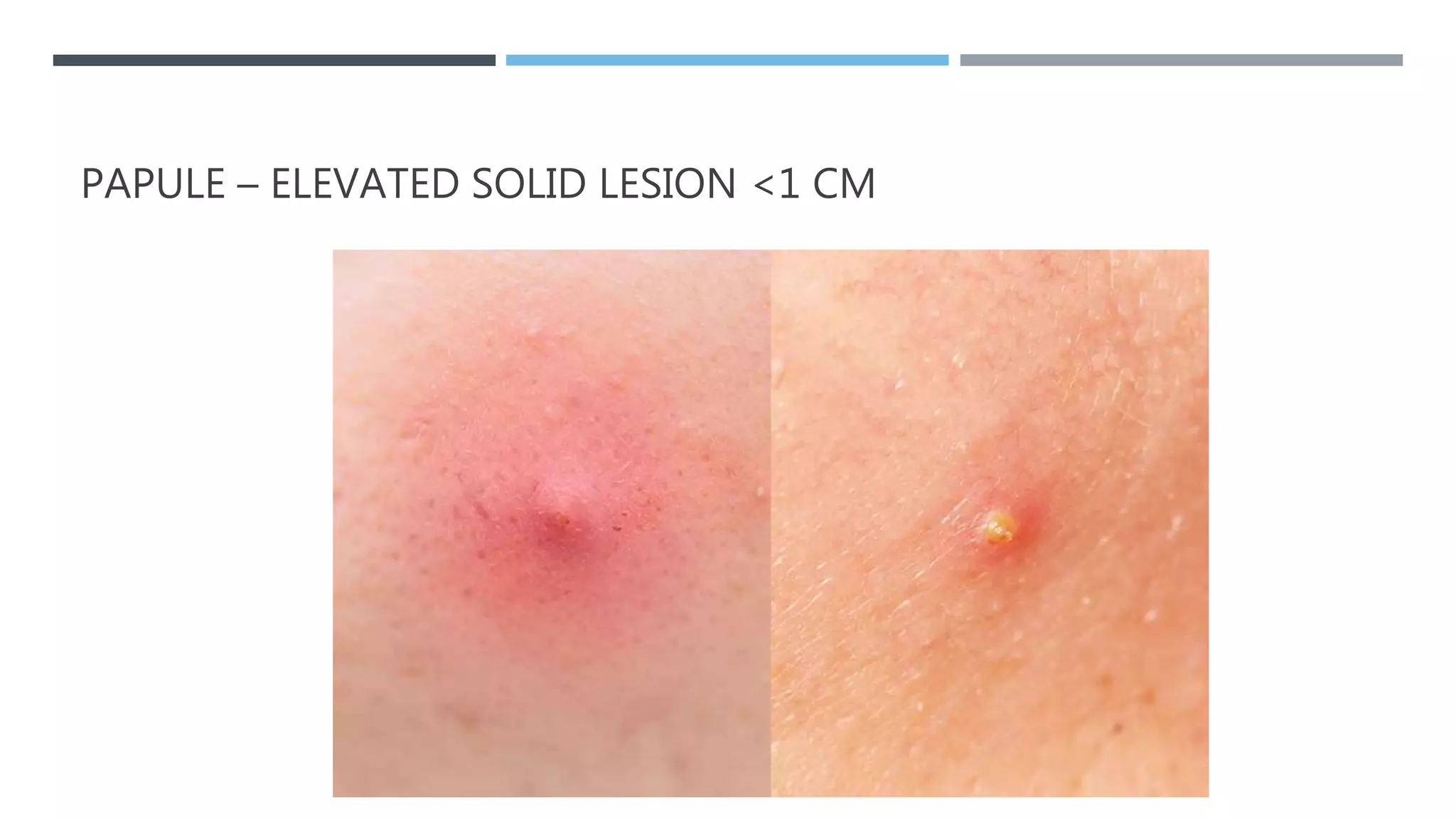 Clinical Assessment of integumentary system | PPTX