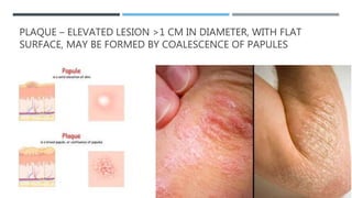 Clinical Assessment of integumentary system | PPTX