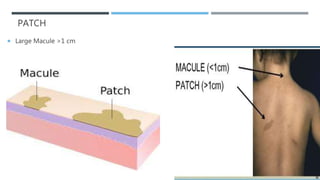 Clinical Assessment of integumentary system | PPTX