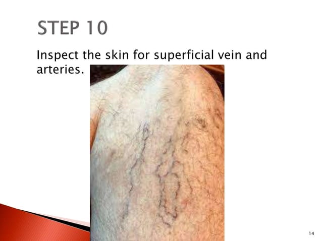 Assessment of integumentry system | PPT