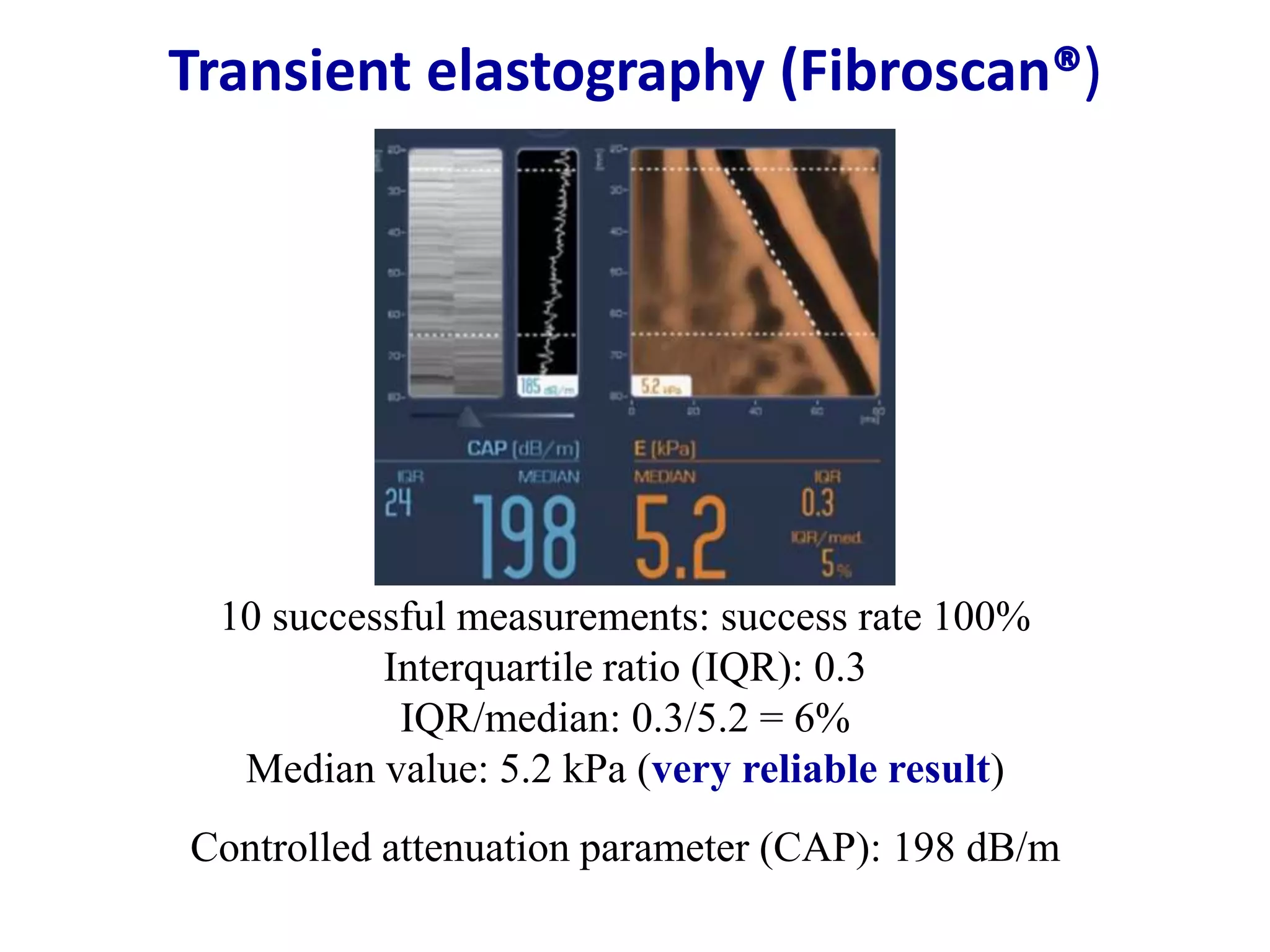 Assessment of liver fibrosis by us elastography | PPTX