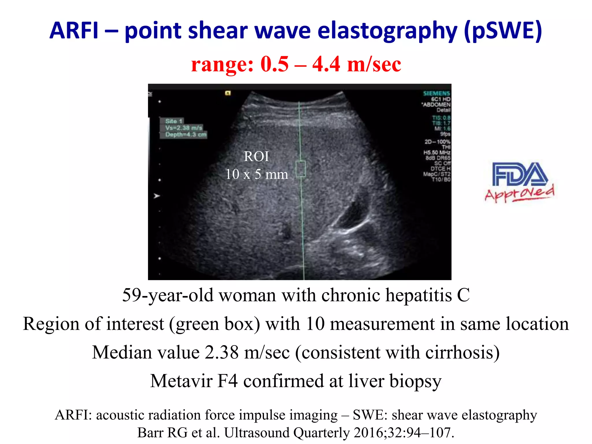 Assessment of liver fibrosis by us elastography | PPTX