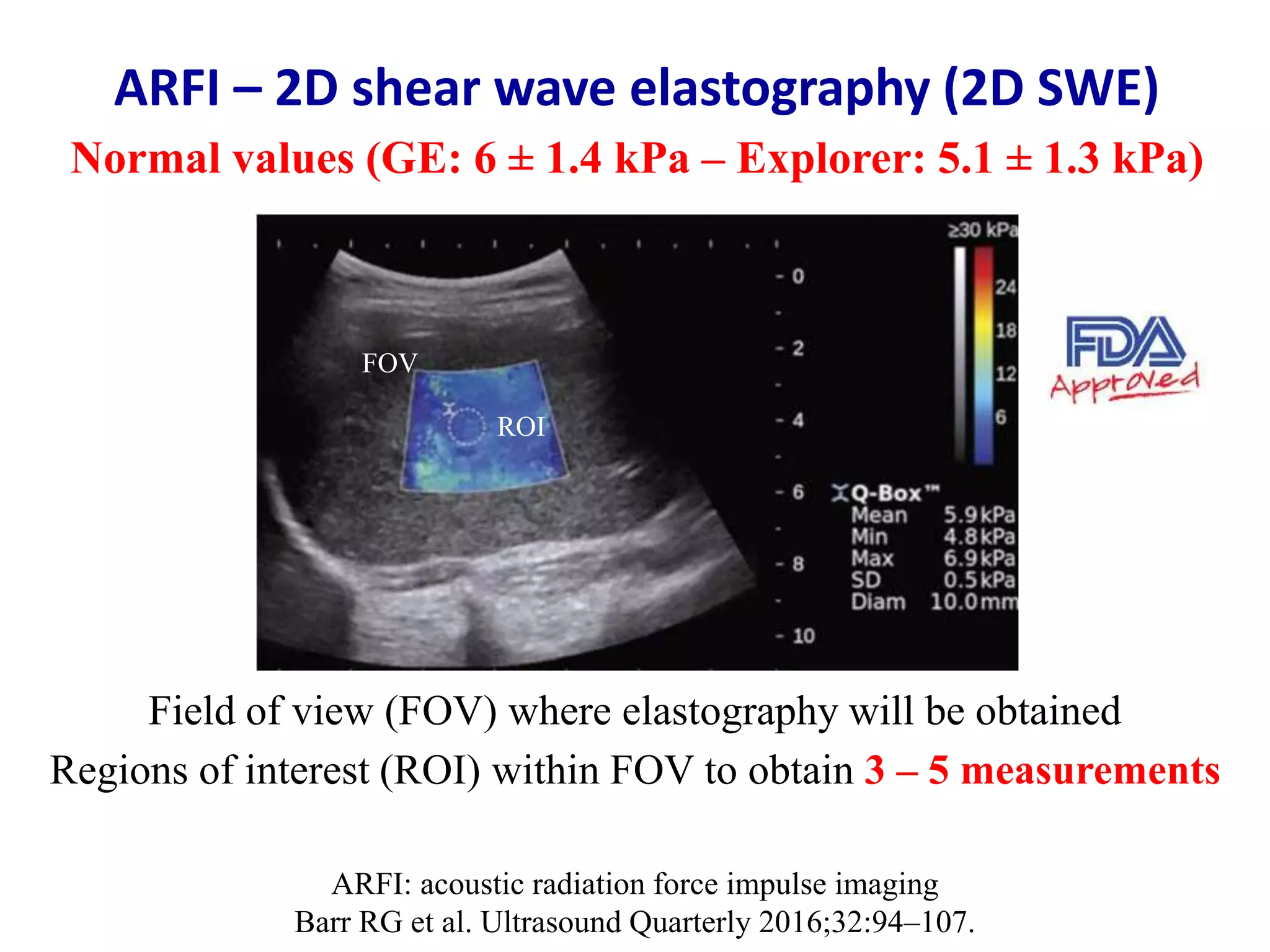 Assessment of liver fibrosis by us elastography | PPTX