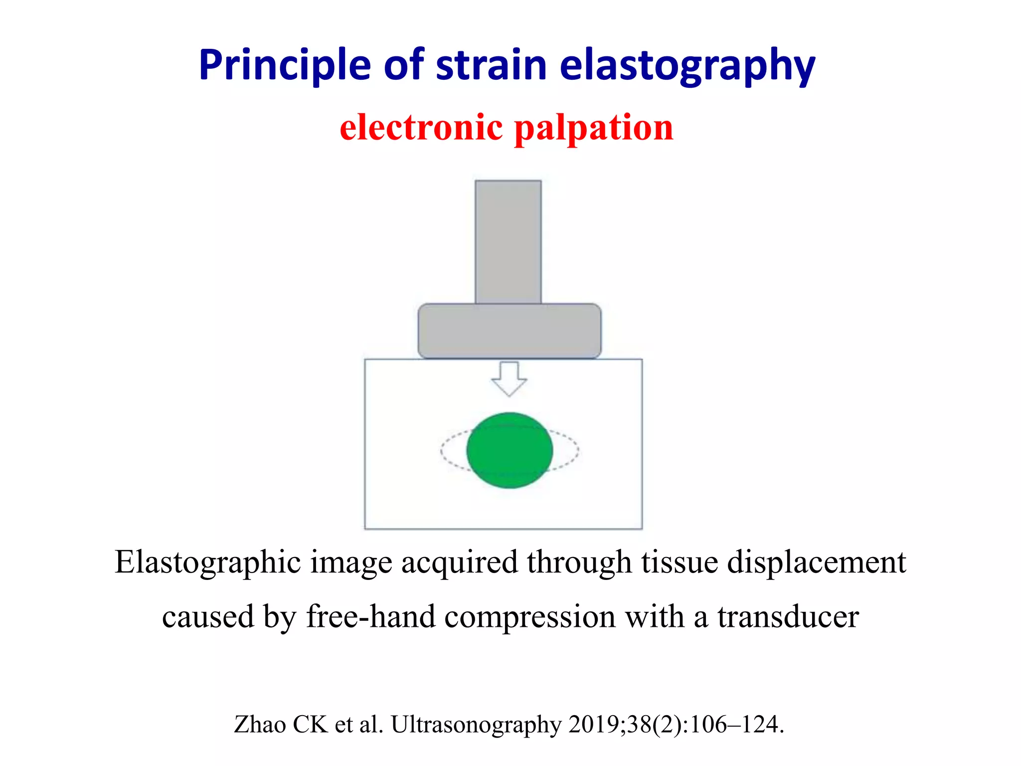 Assessment of liver fibrosis by us elastography | PPTX