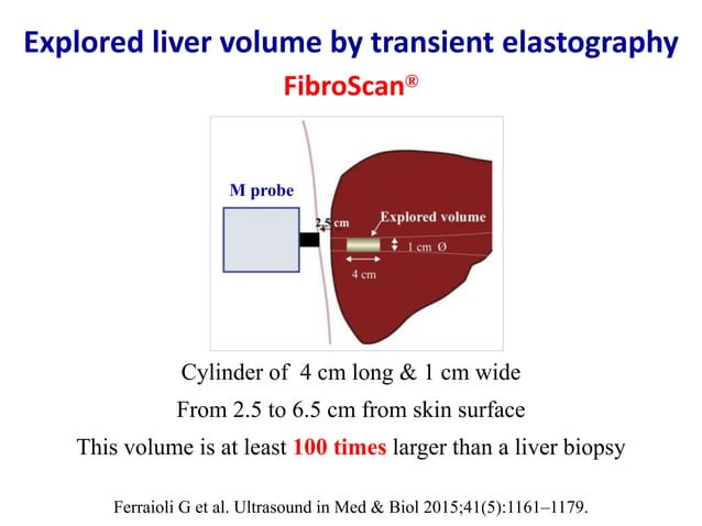 Assessment of liver fibrosis by us elastography | PPTX