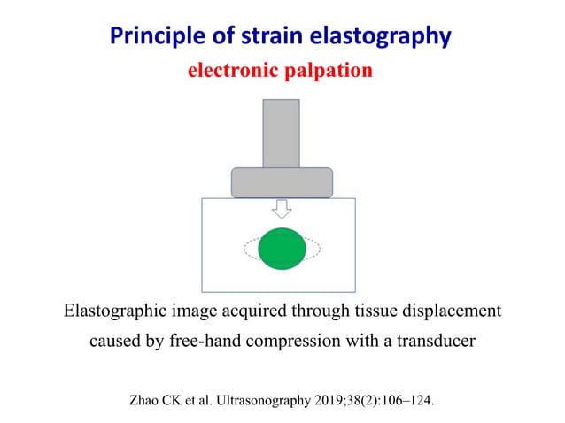 Assessment of liver fibrosis by us elastography | PPT