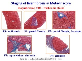 Assessment of liver fibrosis by us elastography | PPT