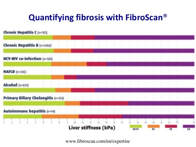 Assessment of liver fibrosis by us elastography