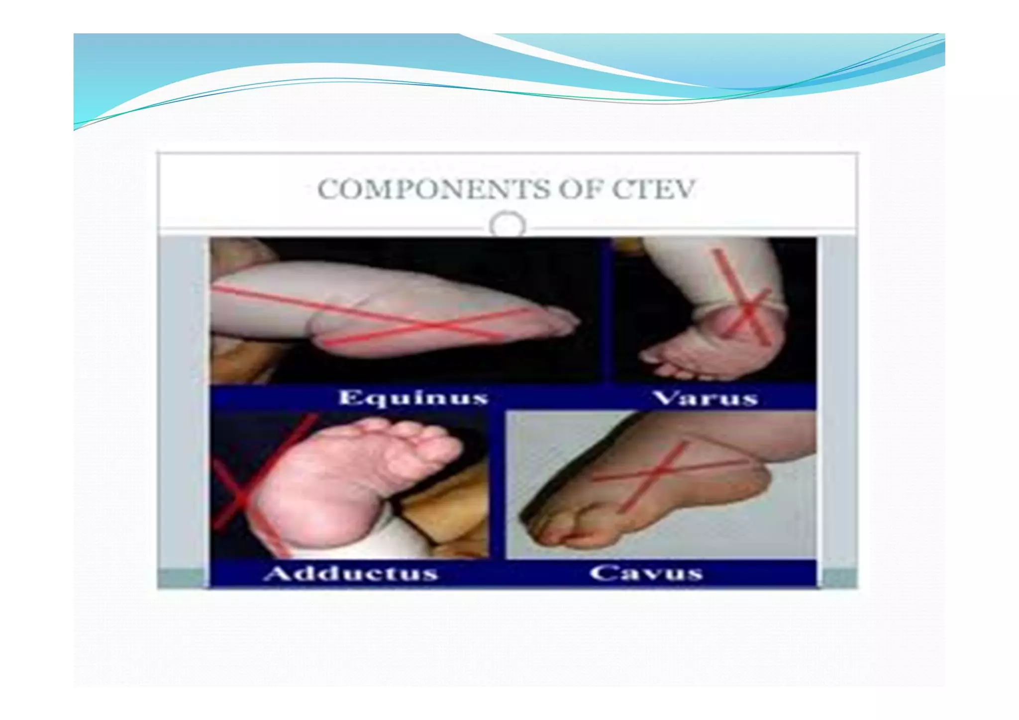 Assessment of lower extermity for prescription of orthoses | PPT