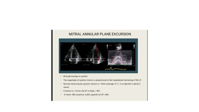 Assessment Of Lv Systolic Function By Echocardiographypptx Ppt