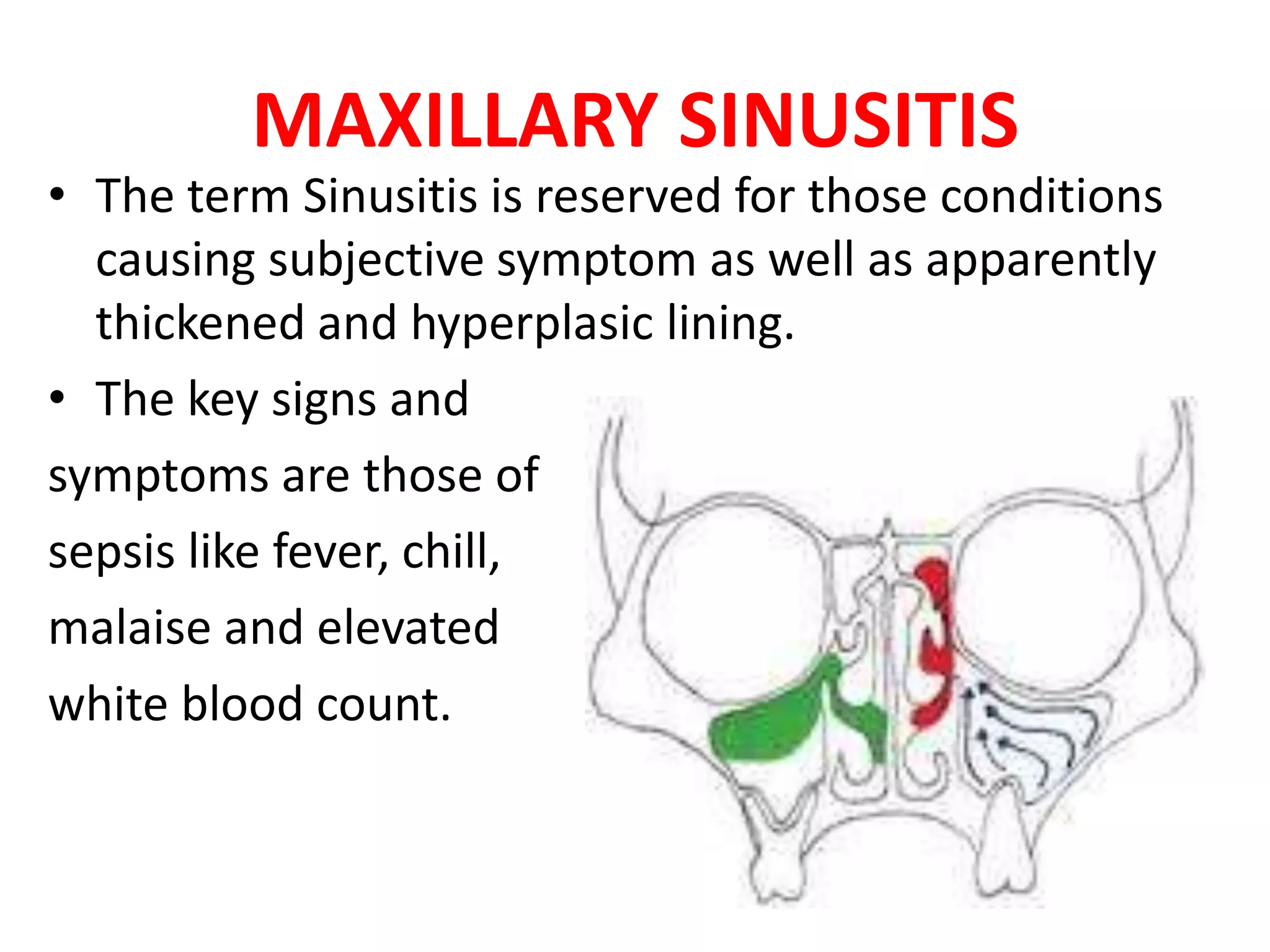 Assessment of maxillary sinuss.pptx