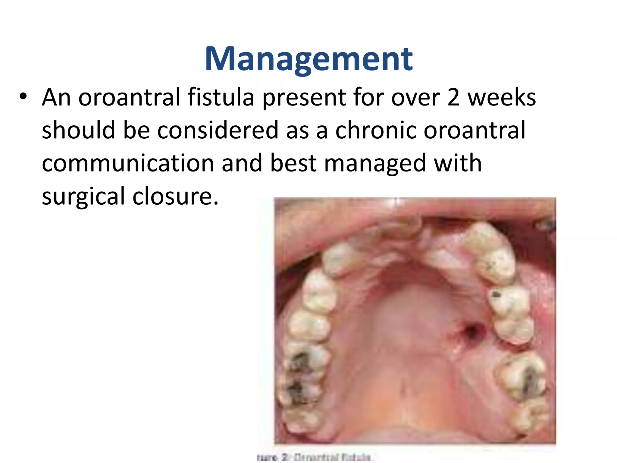 Assessment of maxillary sinuss.pptx