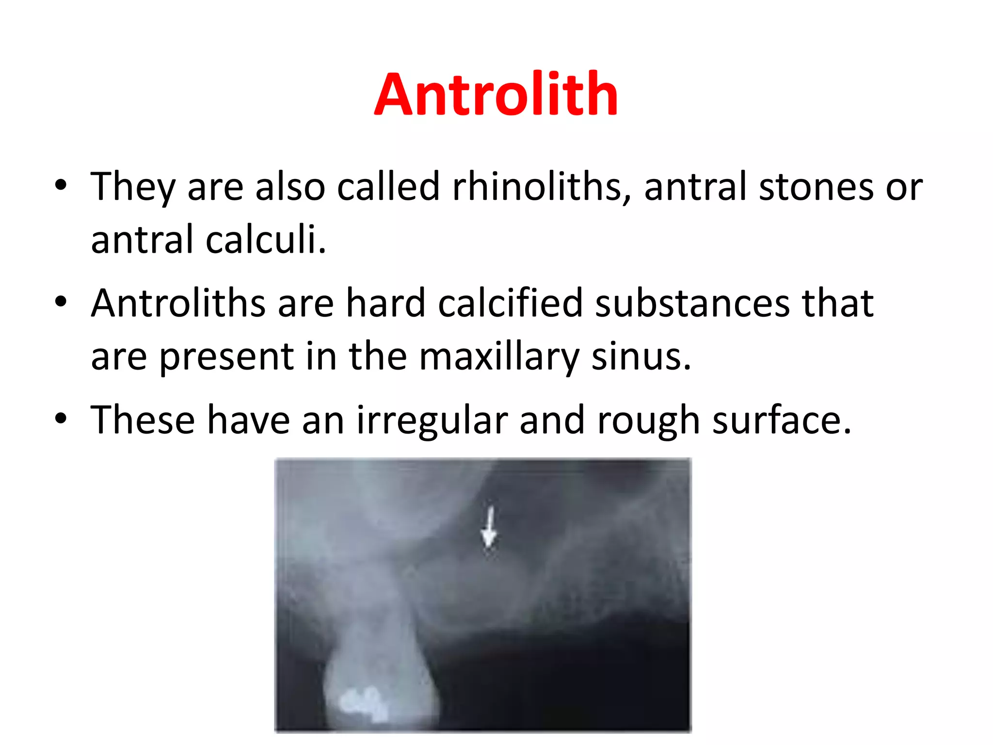 Assessment of maxillary sinuss.pptx