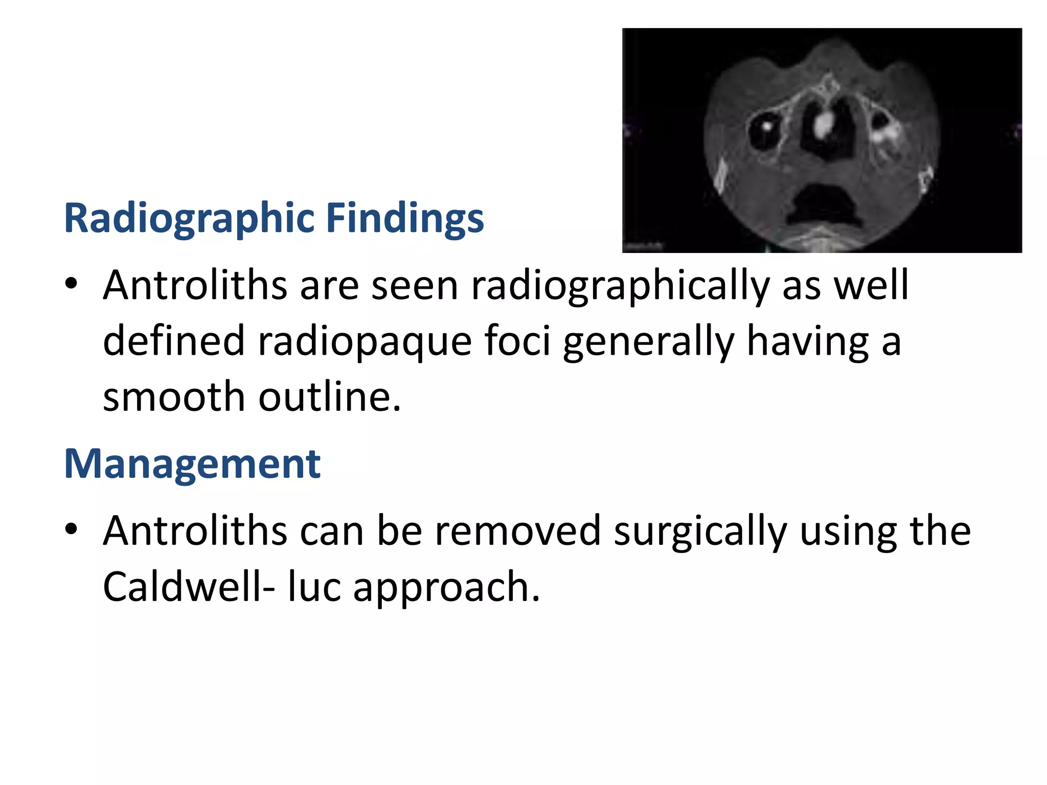 Assessment of maxillary sinuss.pptx