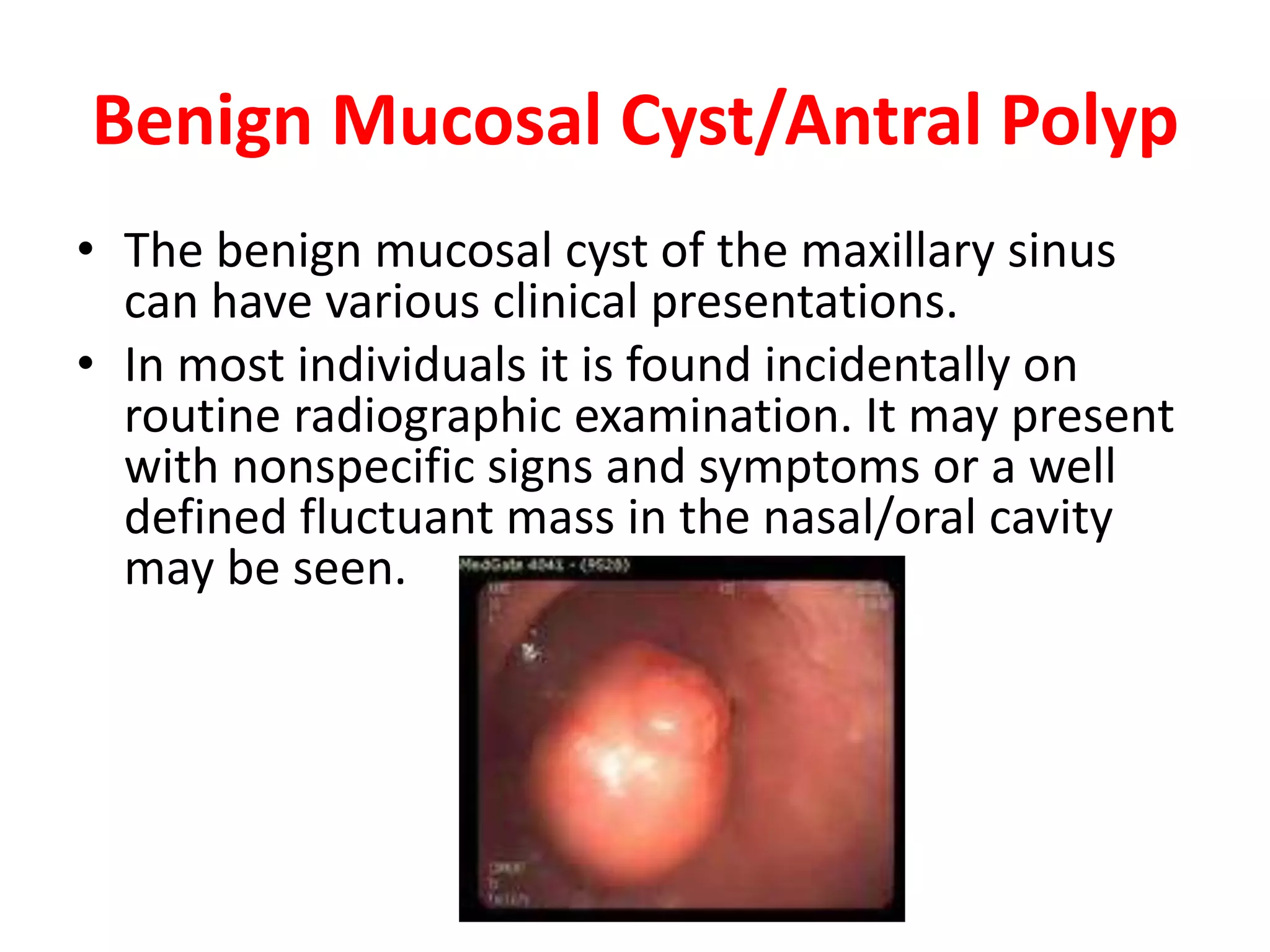 Assessment of maxillary sinuss.pptx