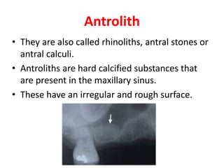 Assessment of maxillary sinuss.pptx