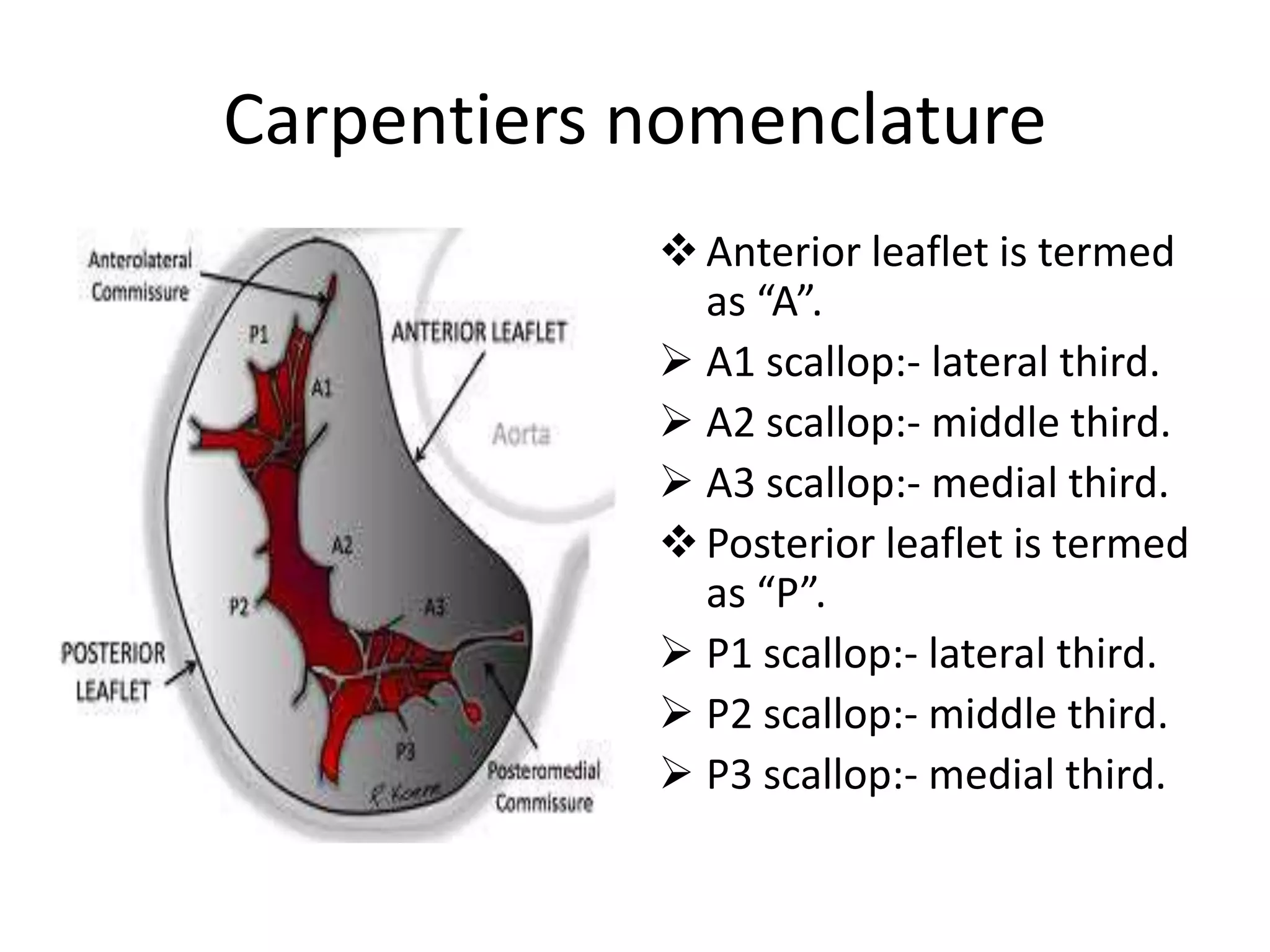 Assessment of mitral valve by TEE | PPTX