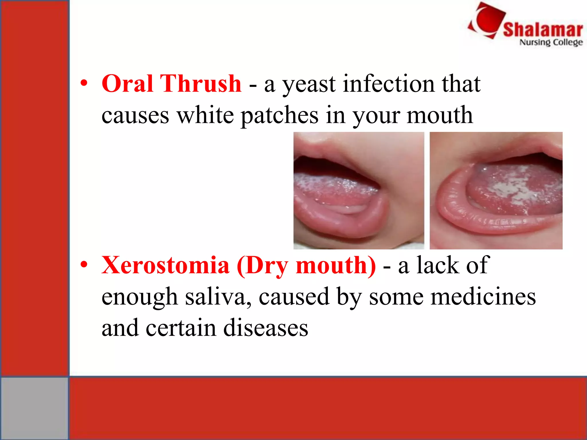 Assessment of Mouth &Pharynx | PDF