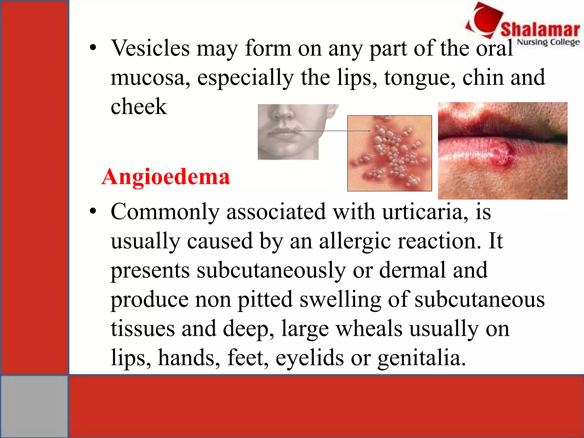 Assessment of Mouth &Pharynx | PDF