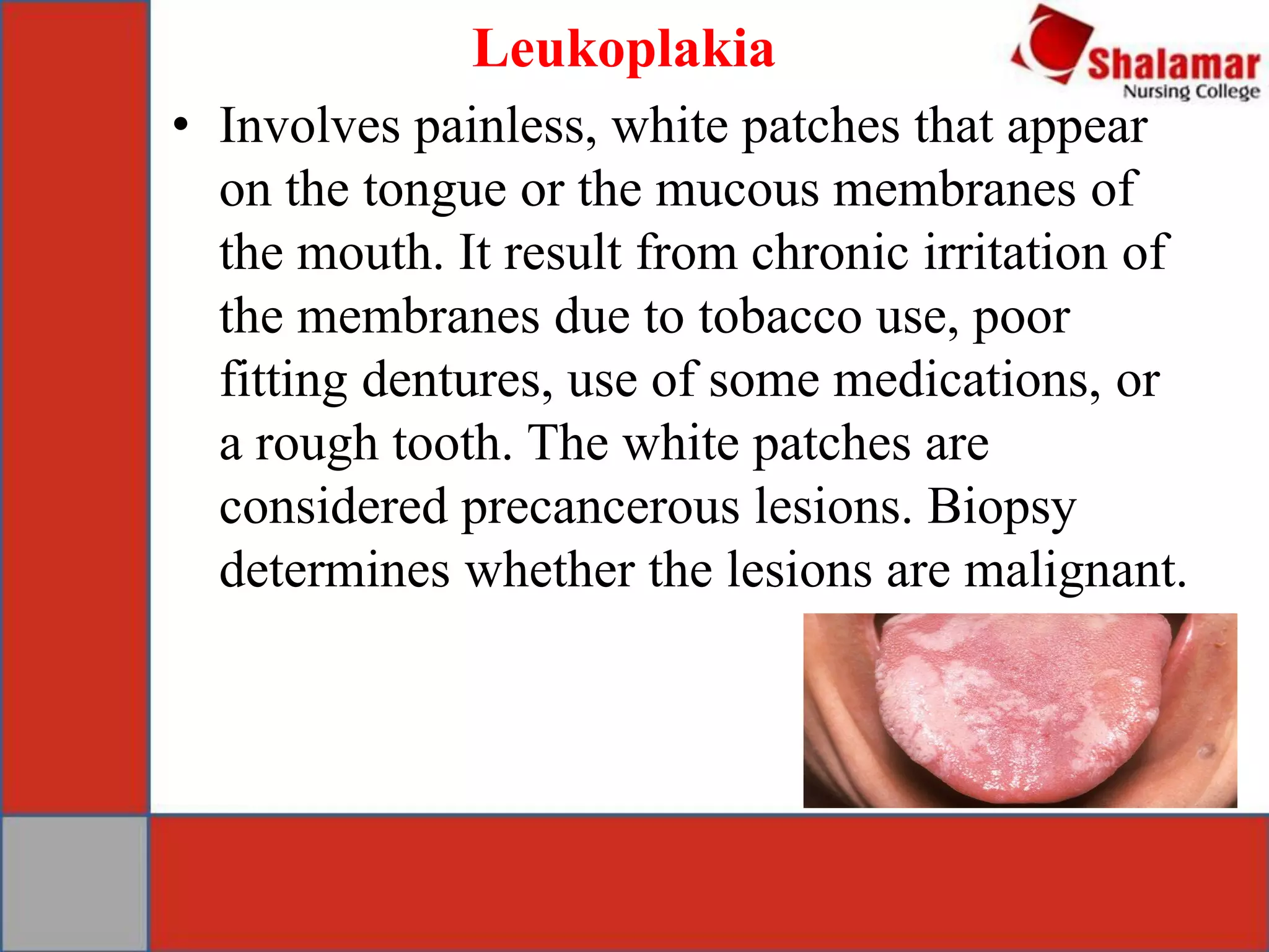 Assessment of Mouth &Pharynx | PDF