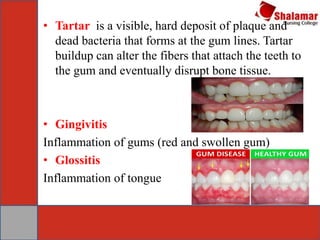 Assessment of Mouth &Pharynx | PDF