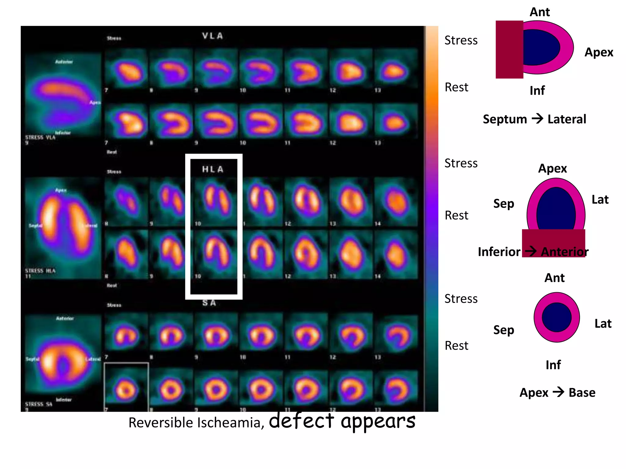 Assessment of myocardial viability | PPTX