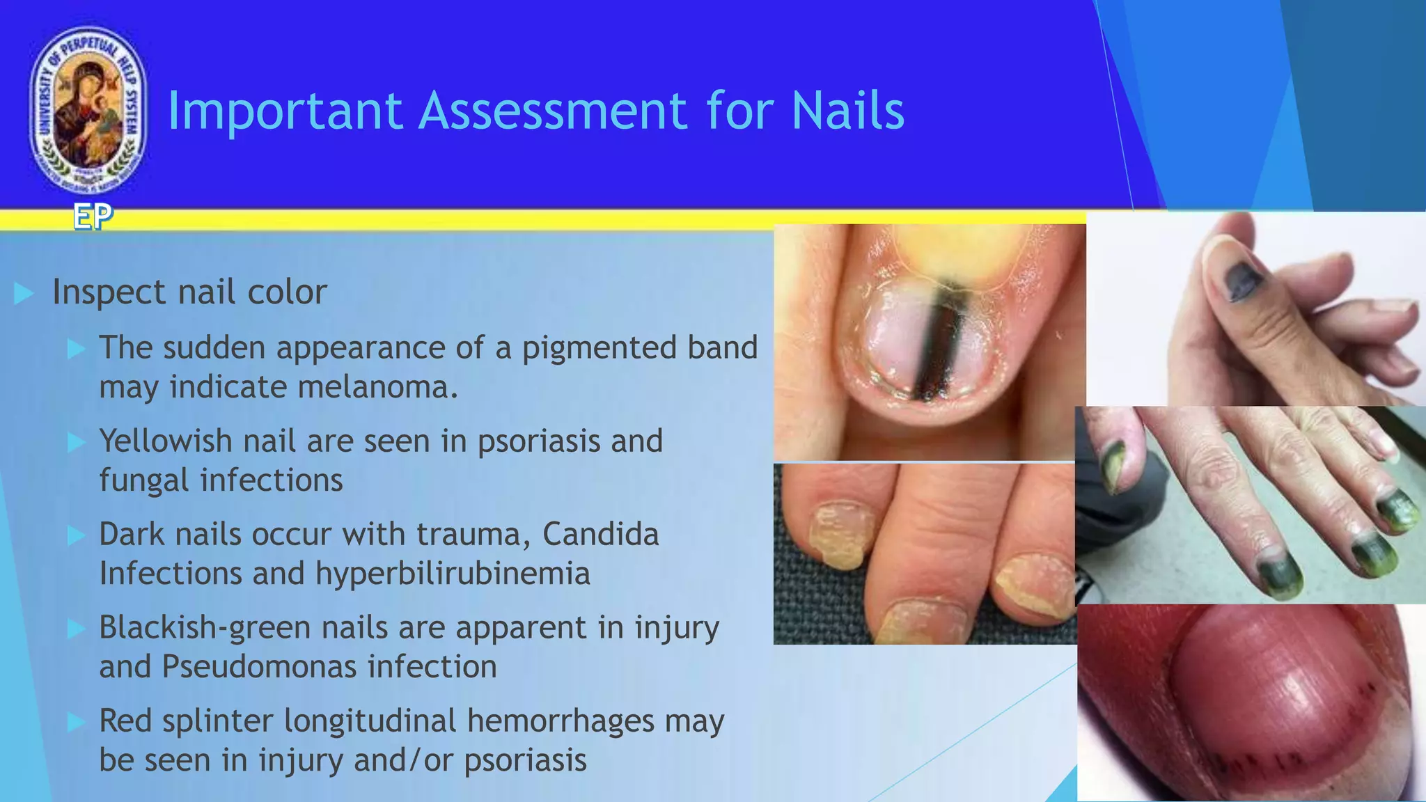 Assessment of Nails.pptx