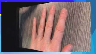 Assessment of Nails.pptx