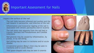 Assessment of Nails.pptx