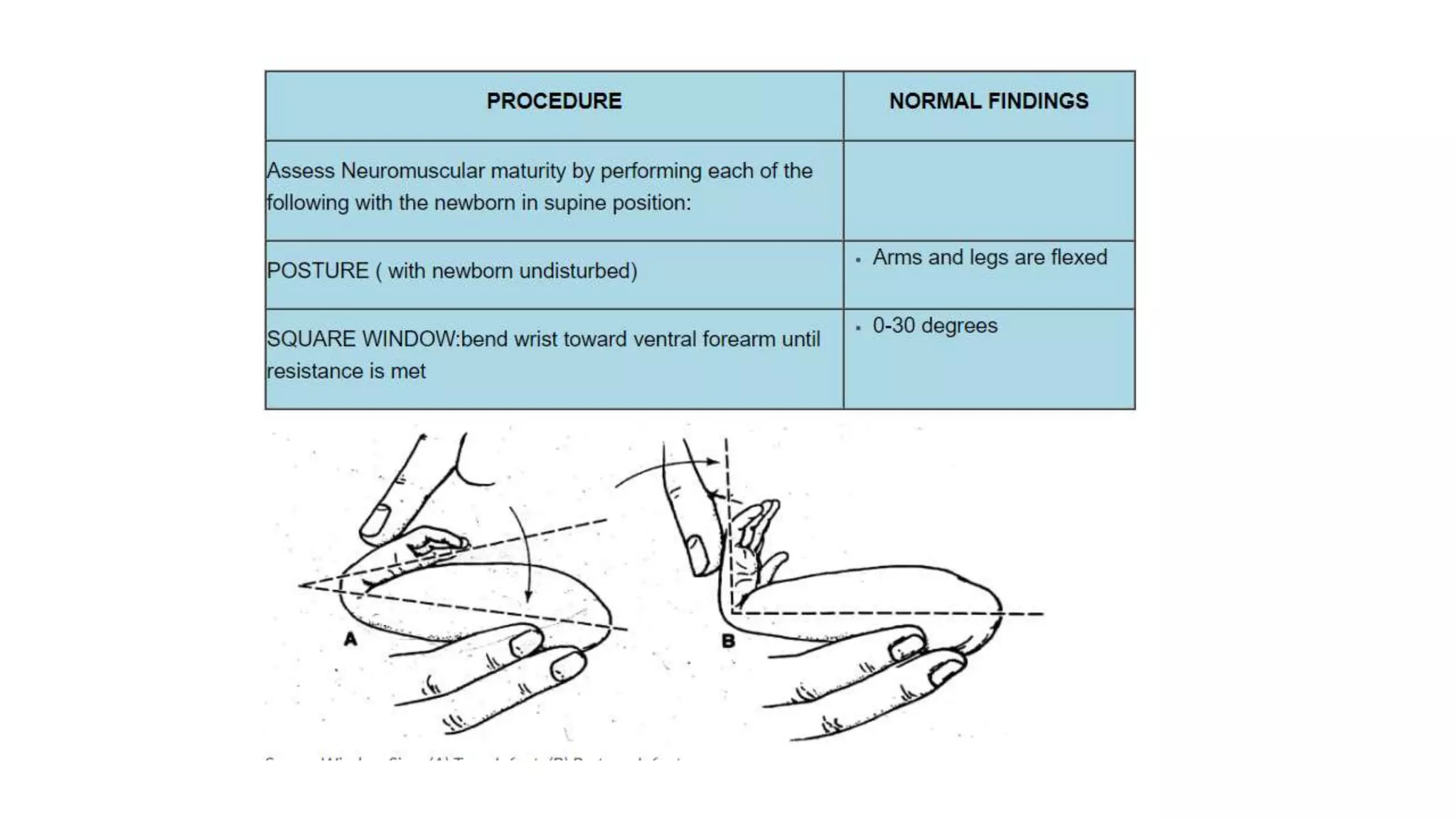 Assessment of NB.pptx